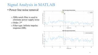 Senior Project Student's Presentation on Design of EMG Signal Recording ...