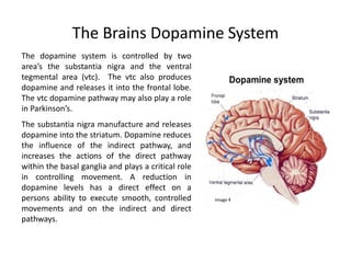 Understanding the Brain: Final Project - Parkinson’s Disease | PPSX