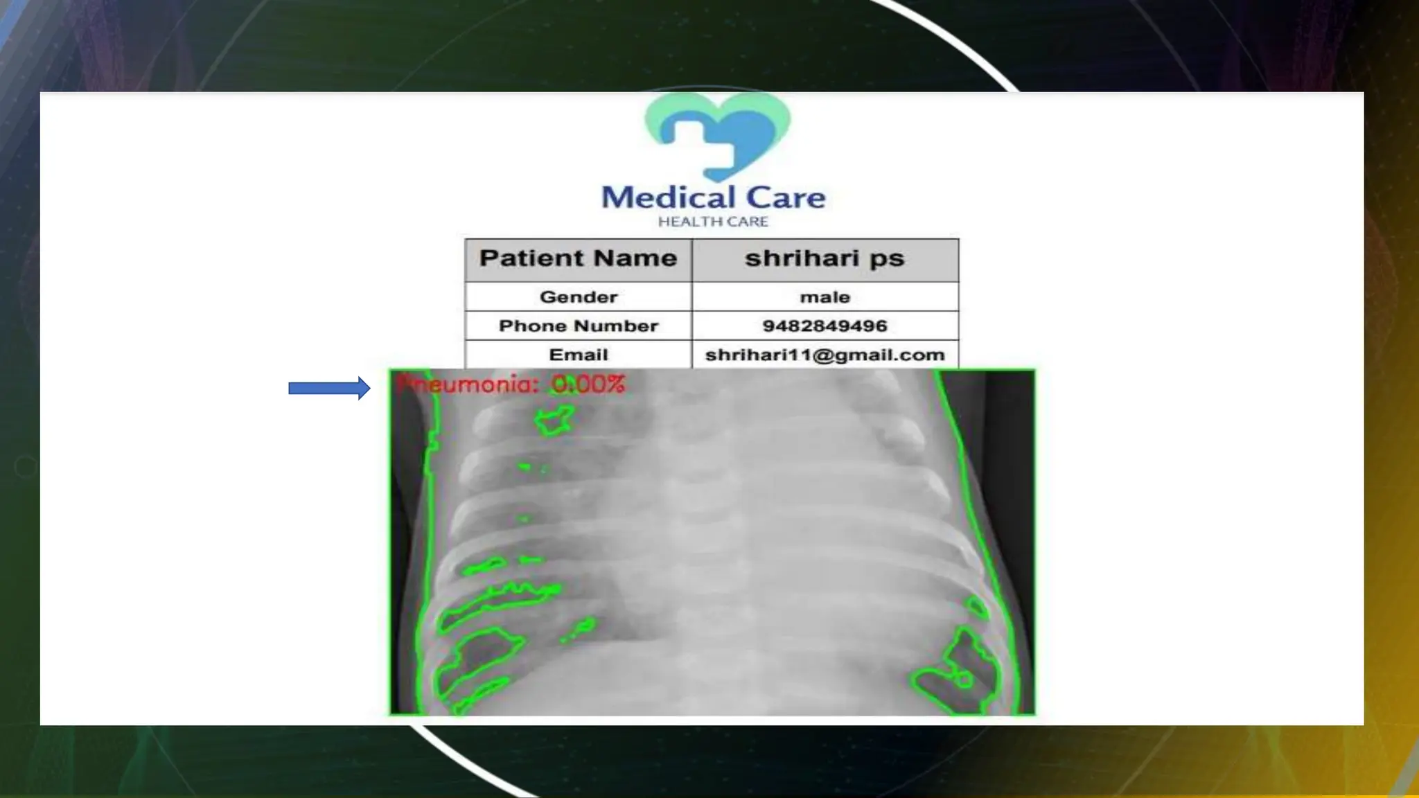 Radiology report generation using scanned images | PPTX