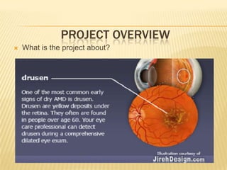 Automatic Drusen Classification | PPTX | Eye and Vision Conditions | Diseases and Conditions