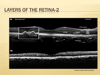 Automatic Drusen Classification | PPTX | Eye and Vision Conditions | Diseases and Conditions