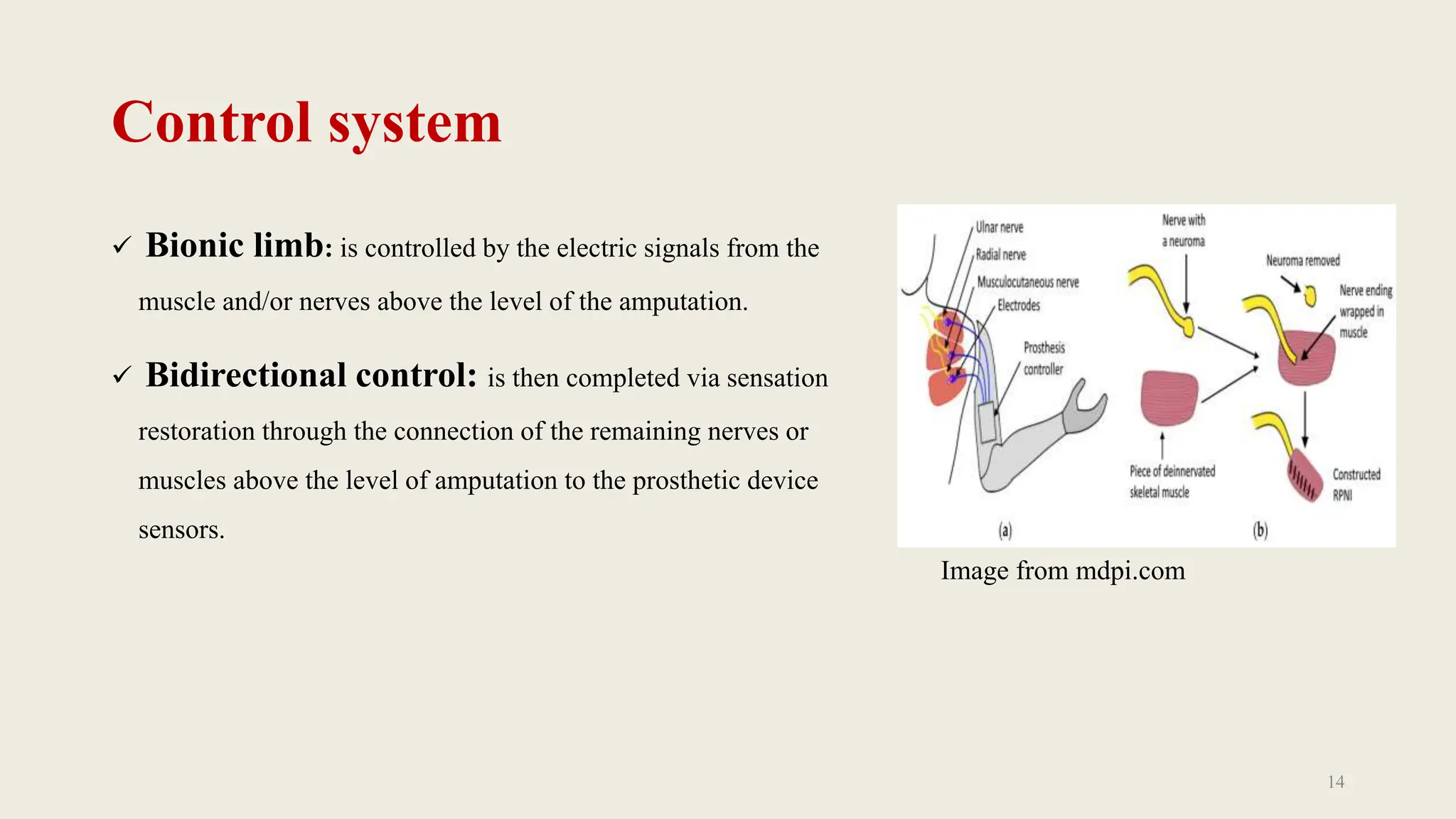 Limb Prosthetic ,types of limb Prosthetic | PPTX