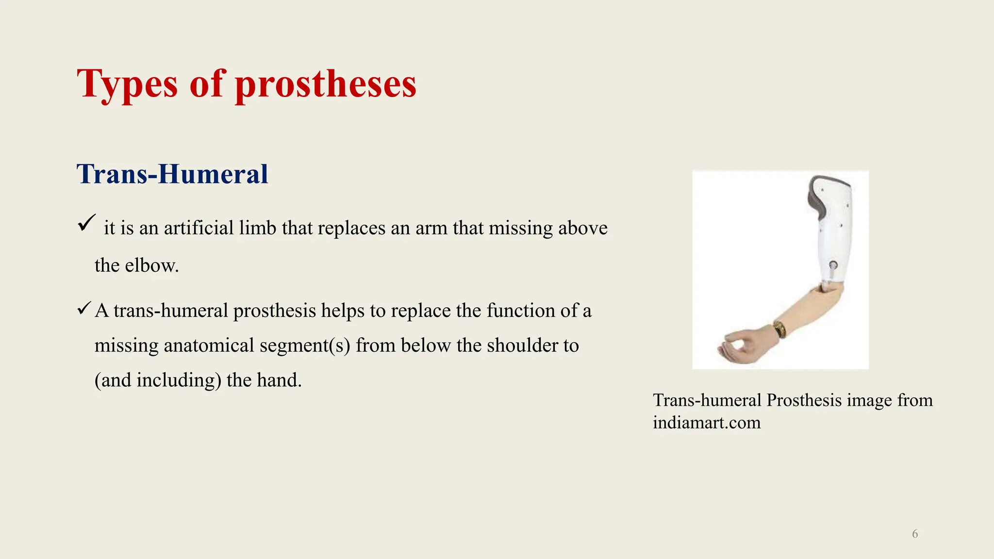 Limb Prosthetic ,types of limb Prosthetic | PPT