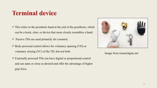 Limb Prosthetic ,types of limb Prosthetic | PPT
