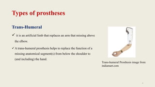 Limb Prosthetic ,types of limb Prosthetic | PPT