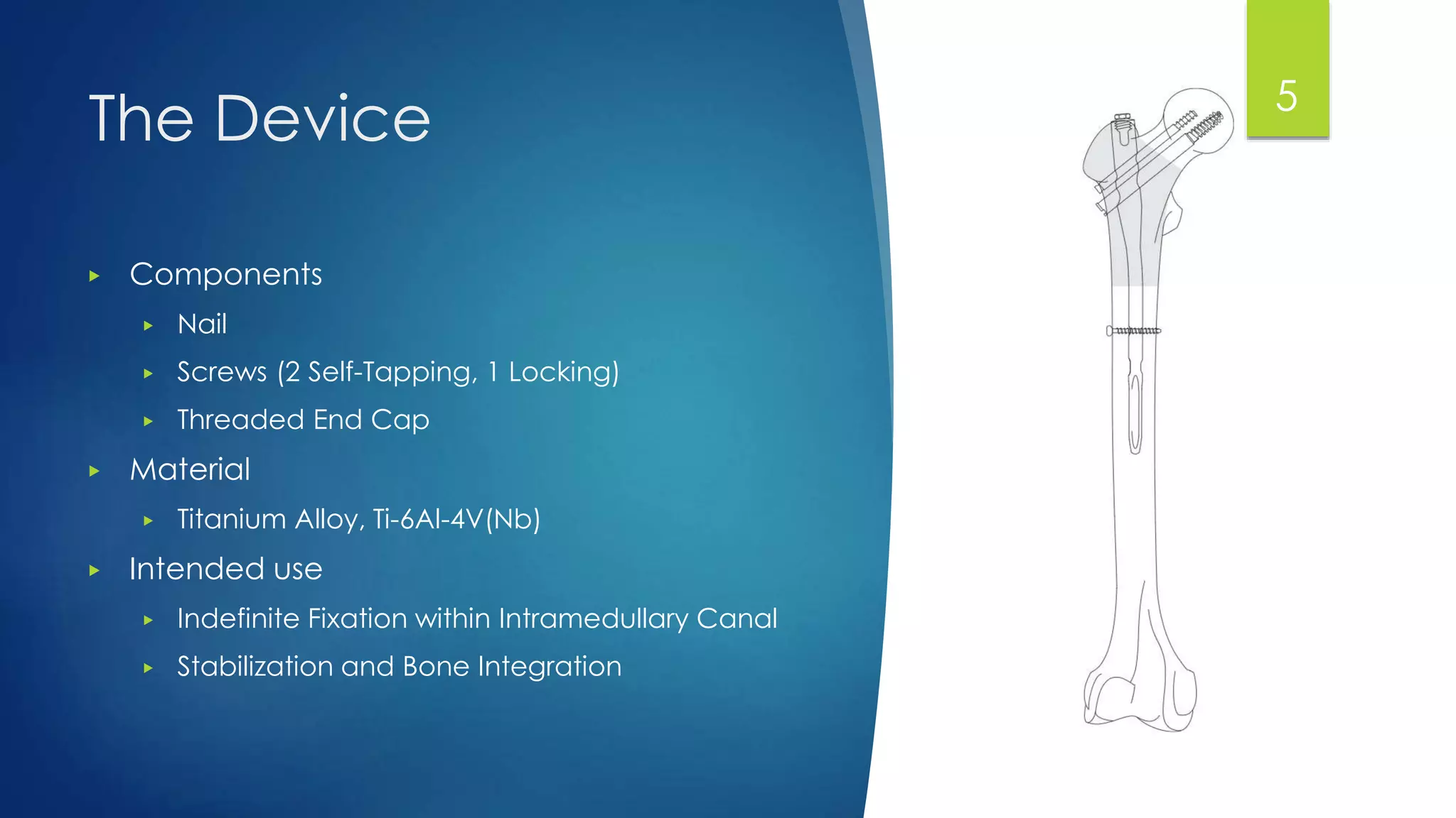 Proximal Femoral Nail | PPTX