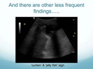 Lung Ultrasound - Final Quiz | PPTX