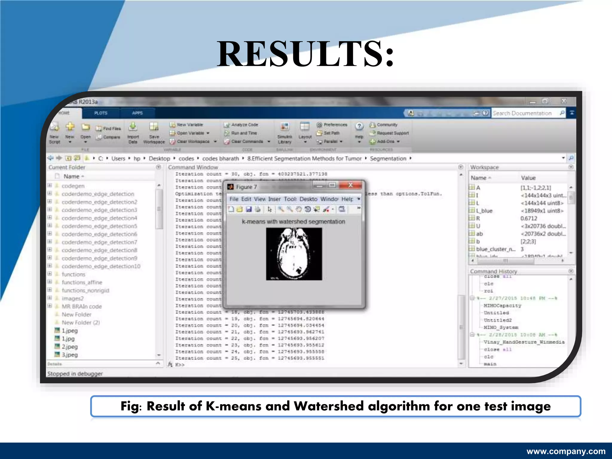 Ppt On Brain Tumor Detection In Mri Images Based On Image Segmentation