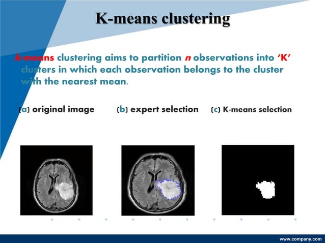 Ppt On Brain Tumor Detection In Mri Images Based On Image Segmentation Pptx Brain And