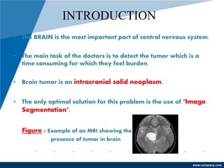 PPT on BRAIN TUMOR detection in MRI images based on IMAGE SEGMENTATION ...
