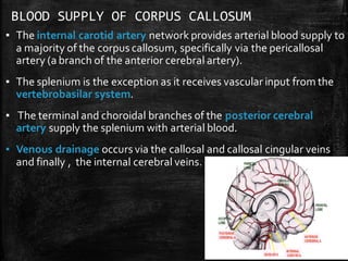 CORPUS CALLOSUM (Final Review Project) | PPT