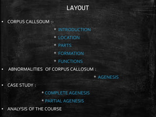 CORPUS CALLOSUM (Final Review Project) | PPT