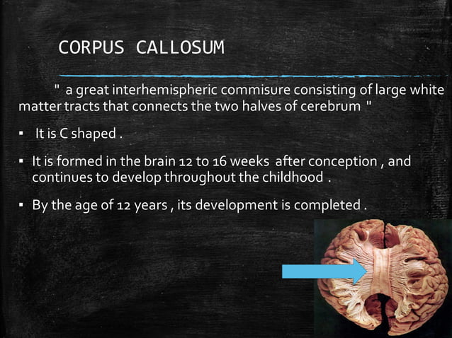 CORPUS CALLOSUM (Final Review Project) | PPT