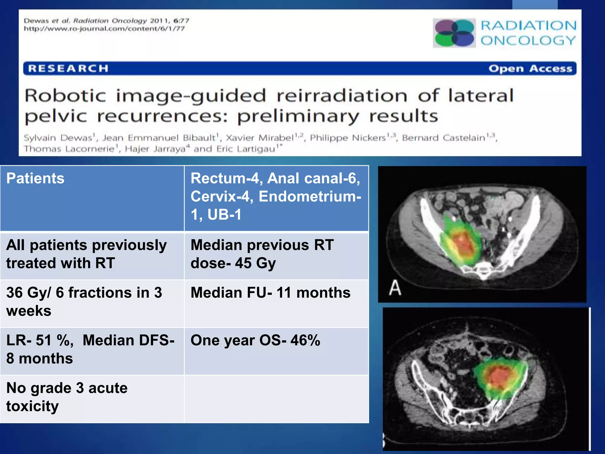 Role of radiotherapy in recurrent carcinoma cervix | PPTX