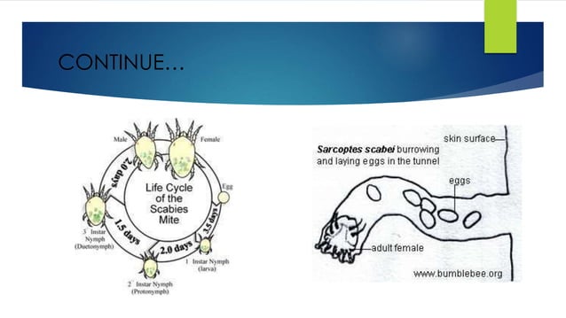 Scabies | PPTX | Infectious Diseases | Diseases and Conditions