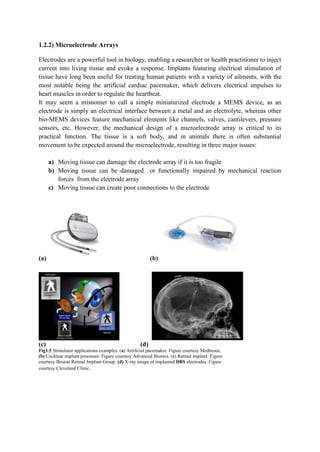 Spinal cord Stimulation | PDF