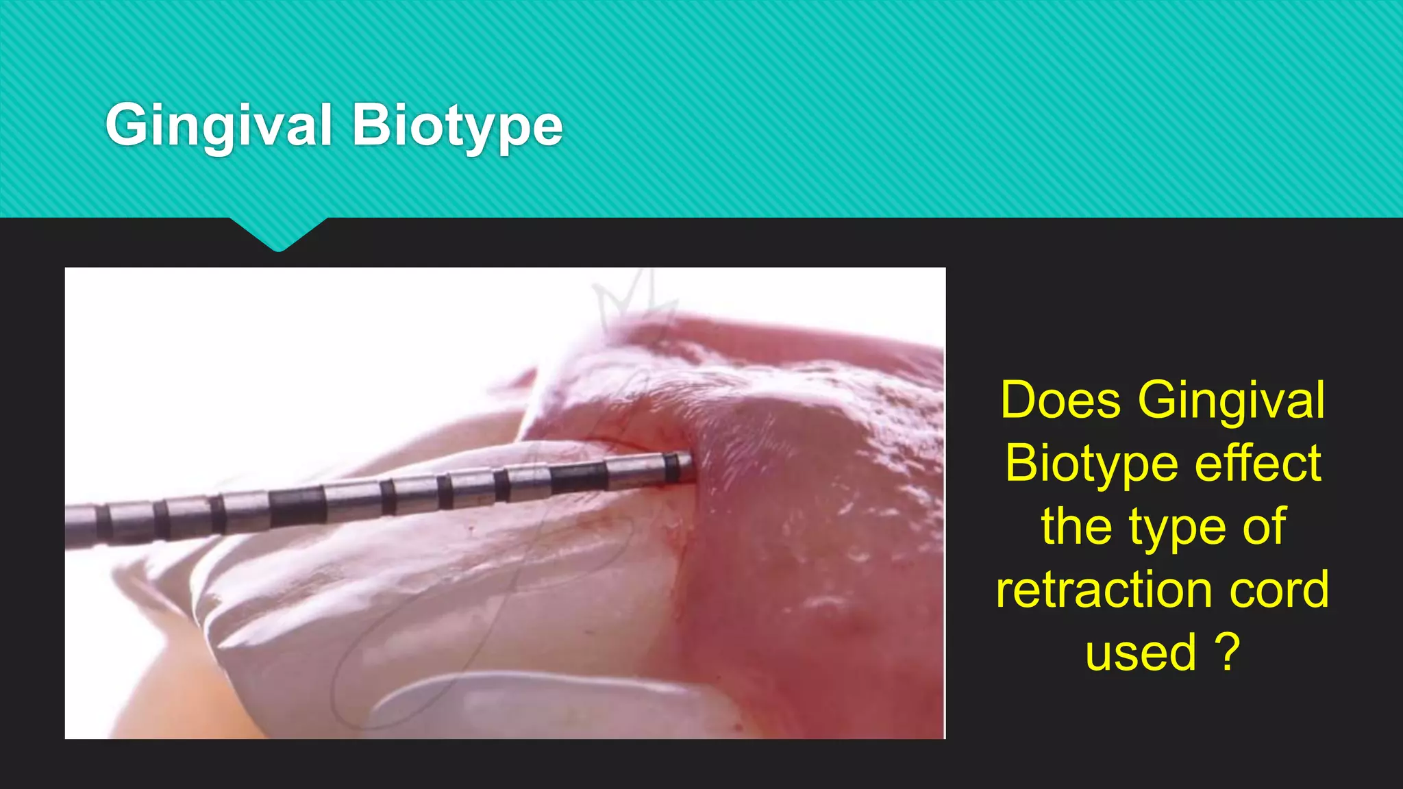 Gingival Retraction | PPTX