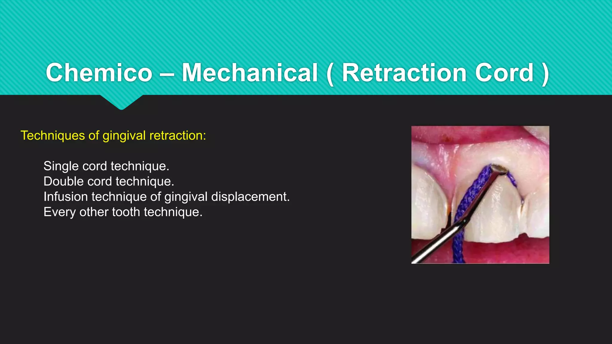 Gingival Retraction | PPTX