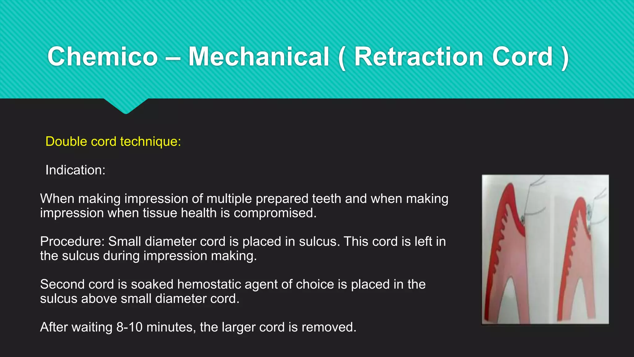 Gingival Retraction | PPTX