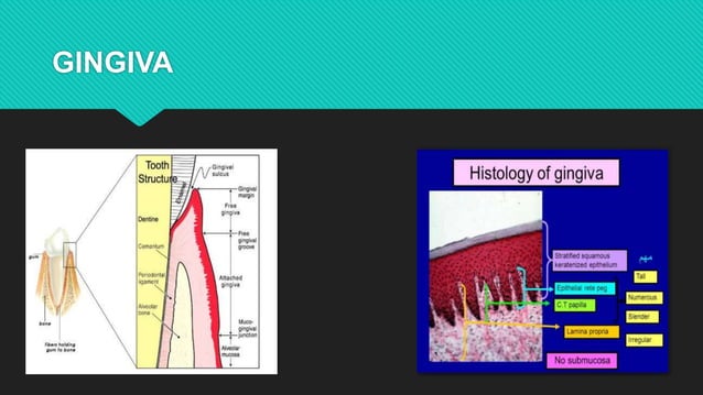 Gingival Retraction | PPTX | Dental Health | Diseases and Conditions