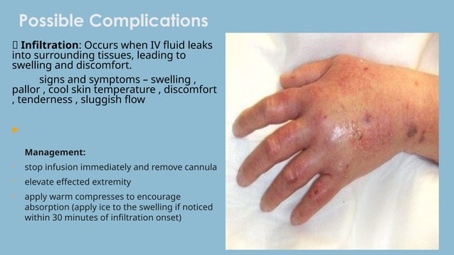 IV CANNULATION , BLADDER CATHERIZATION , INTRODUCTION TO CENTRAL LINES ...