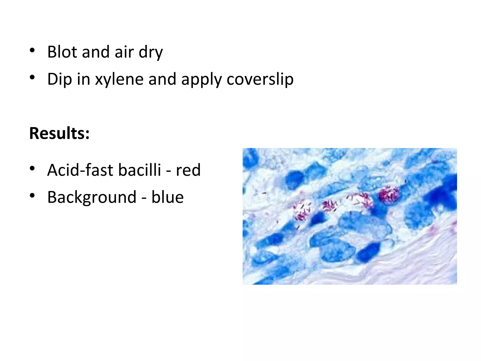 Common Laboratory investigations in dermatology | PPT