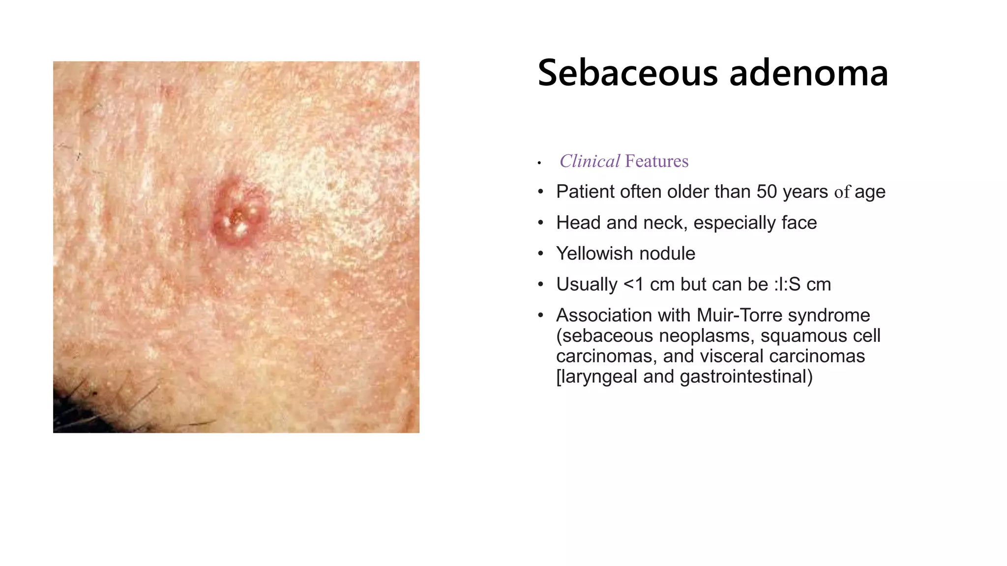 skin adnexal ppt.pptx