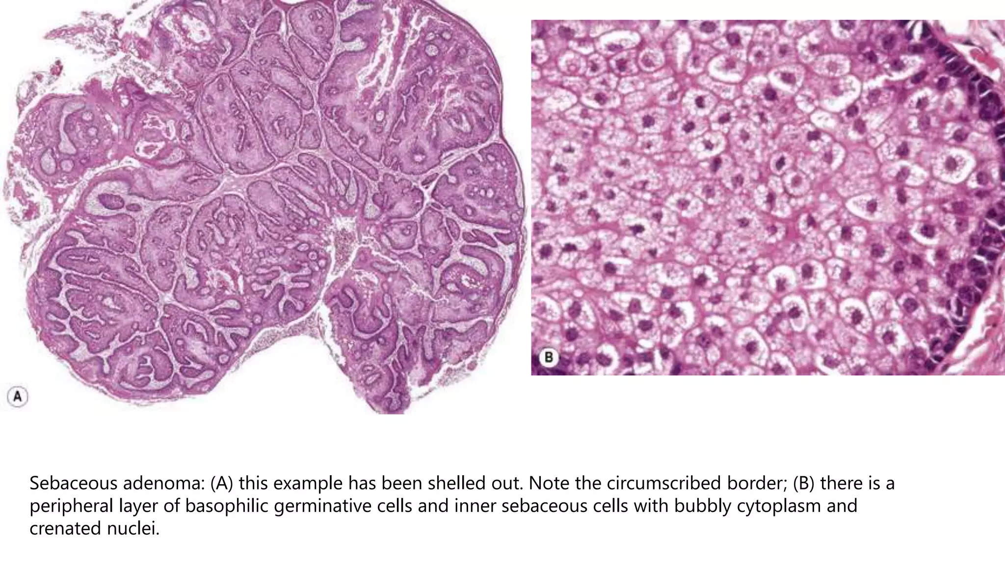 skin adnexal ppt.pptx