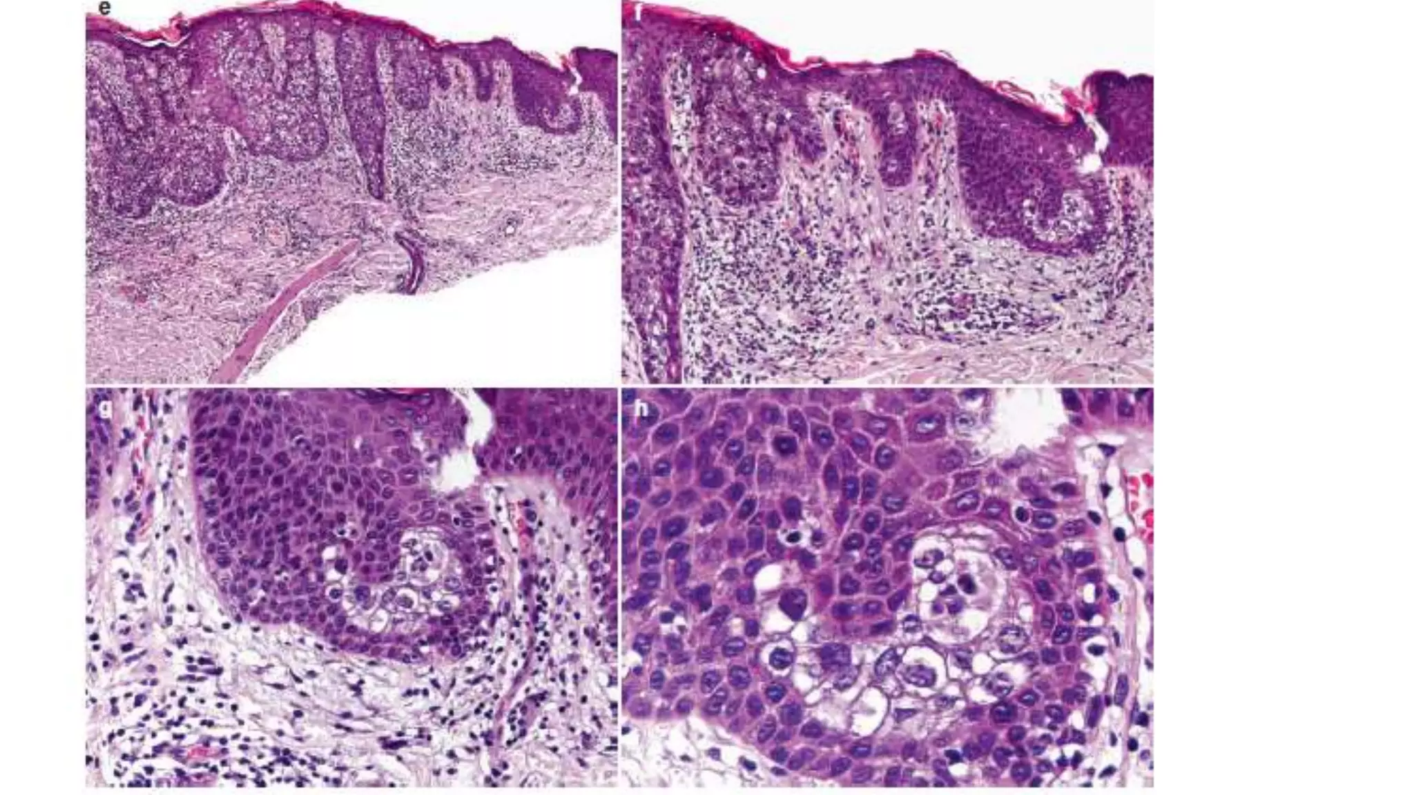 Skin Adnexal Pptpptx