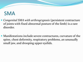 SPINAL MUSCULAR ATROPY | PPTX