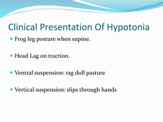 SPINAL MUSCULAR ATROPY | PPTX