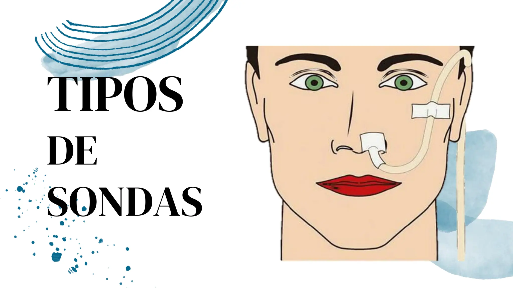 PROCEDIMENTO DE SONDA NASOGASTRICA 2024.pdf | Digestive Disorders ...