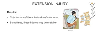 FINAL SPINE INJ MECH. Types mechanism and feathures | PPT