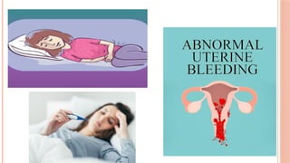 Subinvolution process - post partum period | PPTX