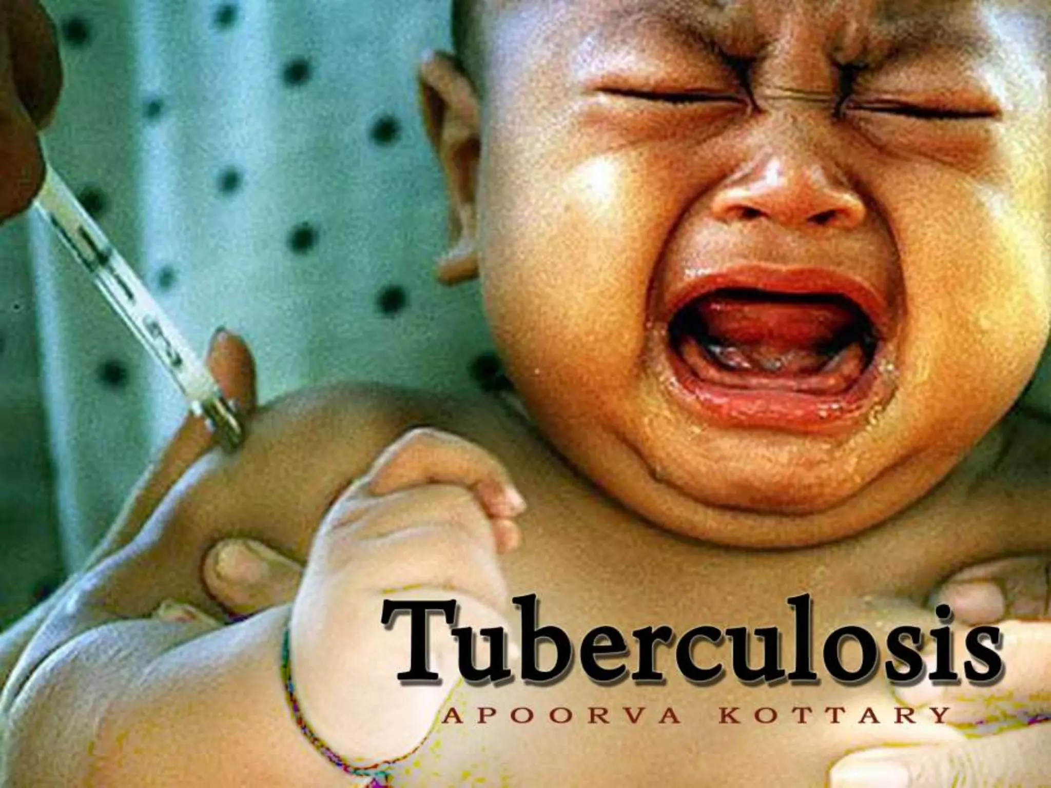 Introduction to Pediatric Tuberculosis | PPTX