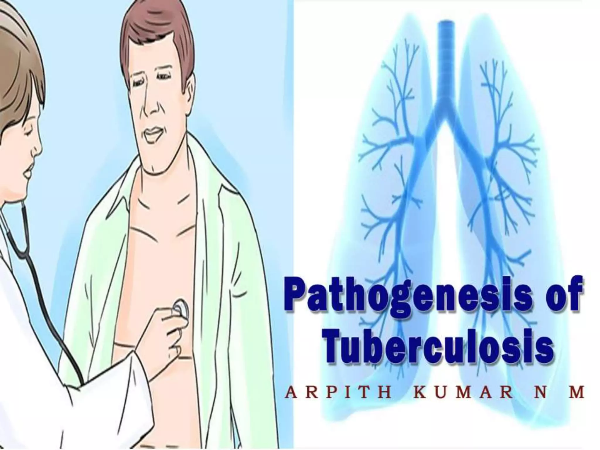 Introduction to Pediatric Tuberculosis | PPTX