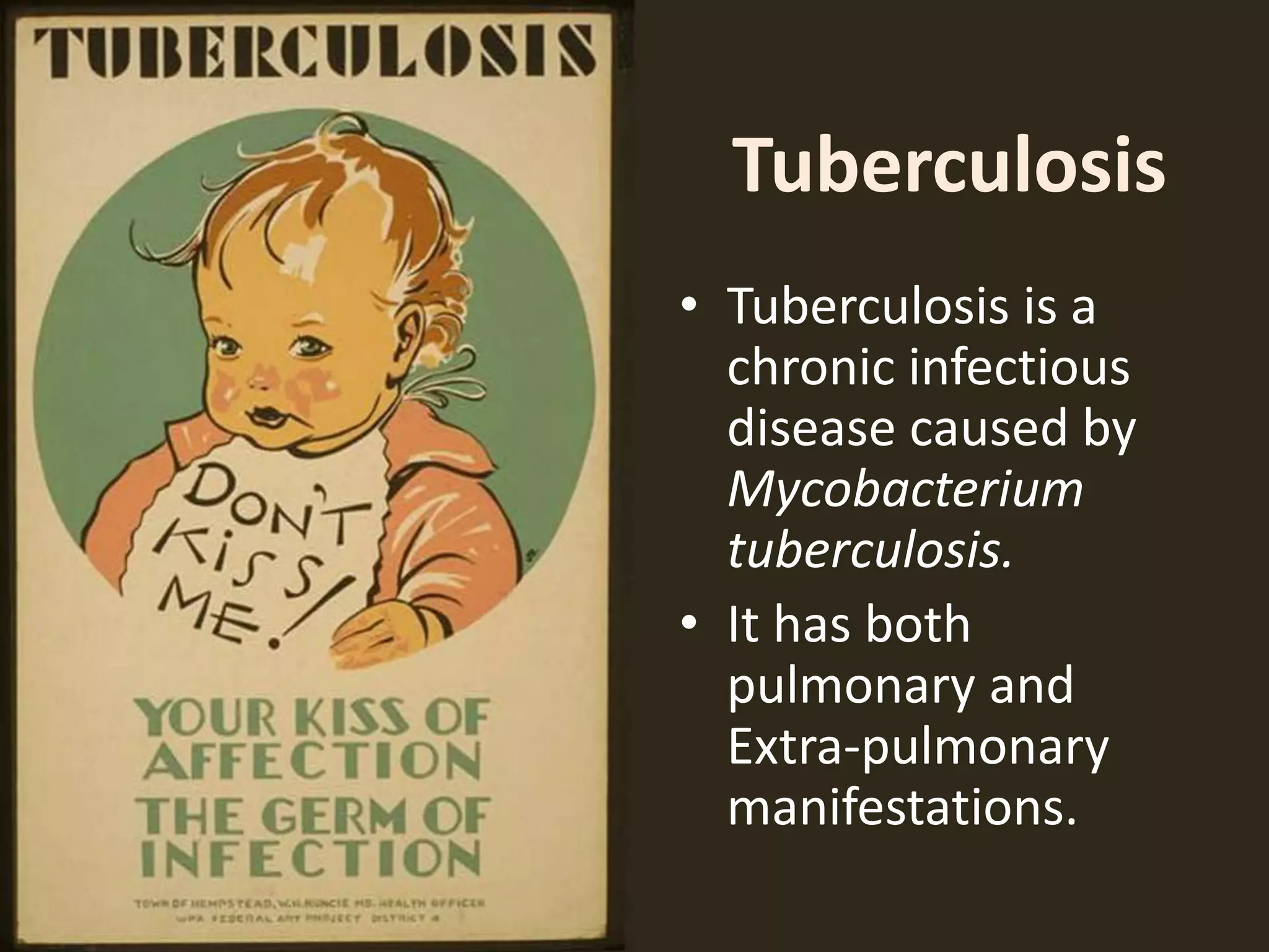 Introduction to Pediatric Tuberculosis | PPTX