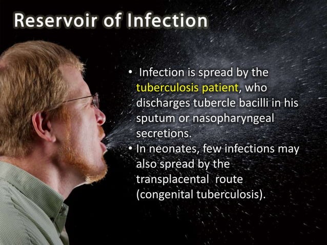Introduction to Pediatric Tuberculosis | PPTX | Infectious Diseases ...