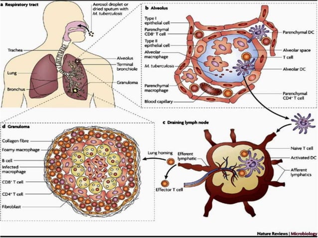 Introduction to Pediatric Tuberculosis | PPTX | Infectious Diseases ...