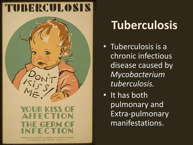 Introduction to Pediatric Tuberculosis | PPTX | Infectious Diseases ...