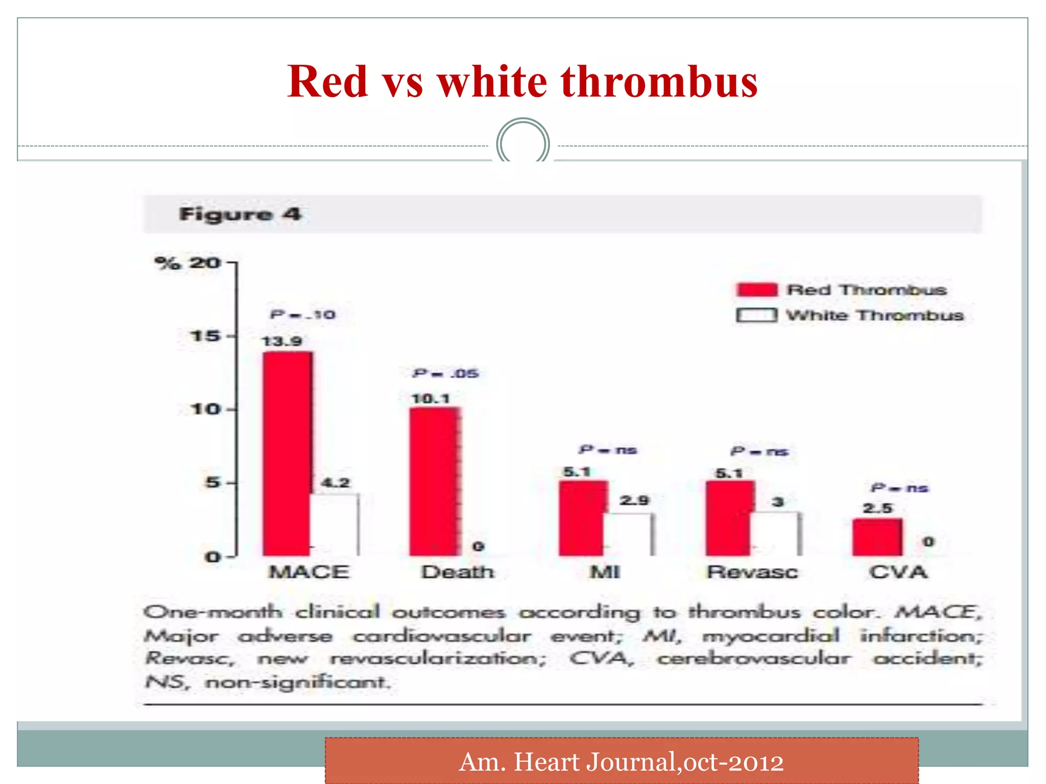 Final thrombus burden | PPTX