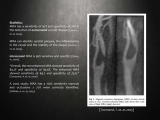 Transient Ischaemic Attack - Imaging Pathways | PPTX