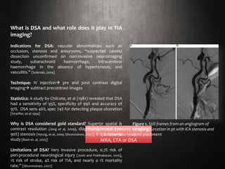Transient Ischaemic Attack - Imaging Pathways | PPTX