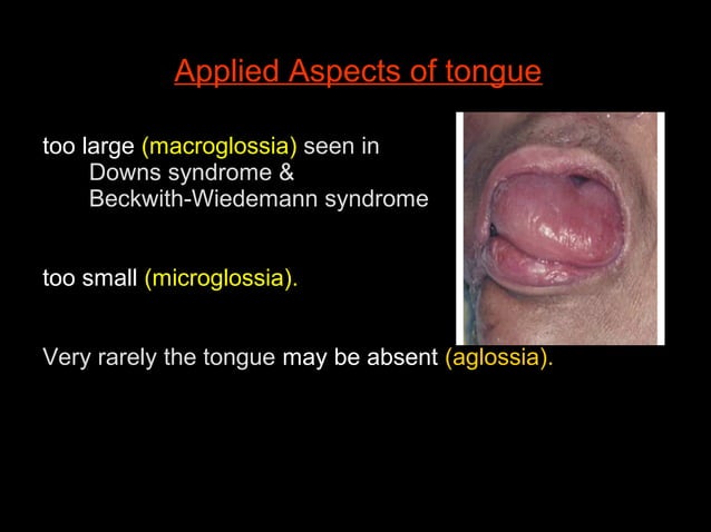 tongue and palate | PPT