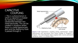 Electrosurgery and Energised Dissection | PPTX