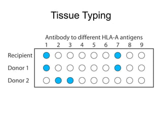 Final Transplantation.ppt transplantation | PPT