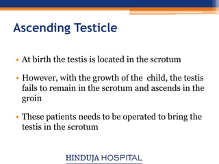 Hinduja Hospital Webinar on Understanding Undescended Testis | PPTX