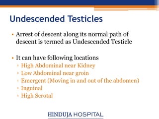 Hinduja Hospital Webinar on Understanding Undescended Testis | PPTX