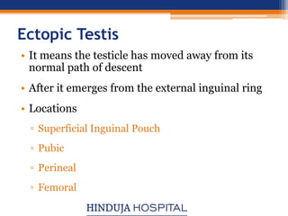 Hinduja Hospital Webinar on Understanding Undescended Testis | PPTX ...