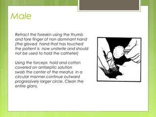 Final urinary bladder catheterisation | PPT | Surgery | Medical Health